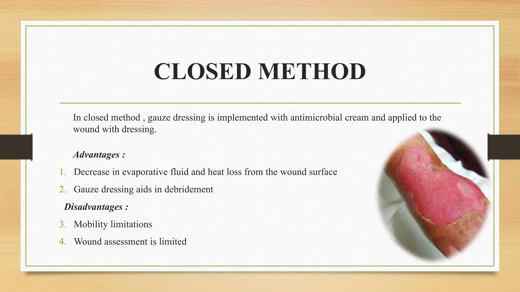 BURN DRESSING, demonstration with step by step | PPTX