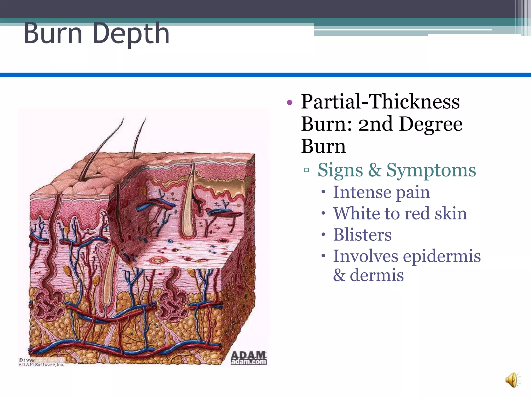 Burn drneerajjain with audio | PPTX
