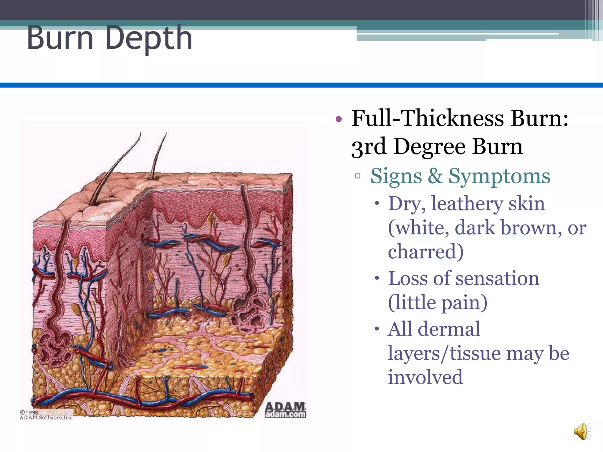 Burn drneerajjain with audio | PPTX