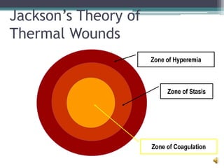 Burn drneerajjain with audio | PPTX