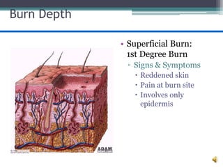 Burn drneerajjain with audio | PPTX