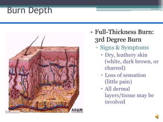 Burn drneerajjain with audio | PPTX