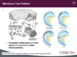 Factors Affecting Meniscus Tear Healing and Prognosis - AOSSM Lecture ...