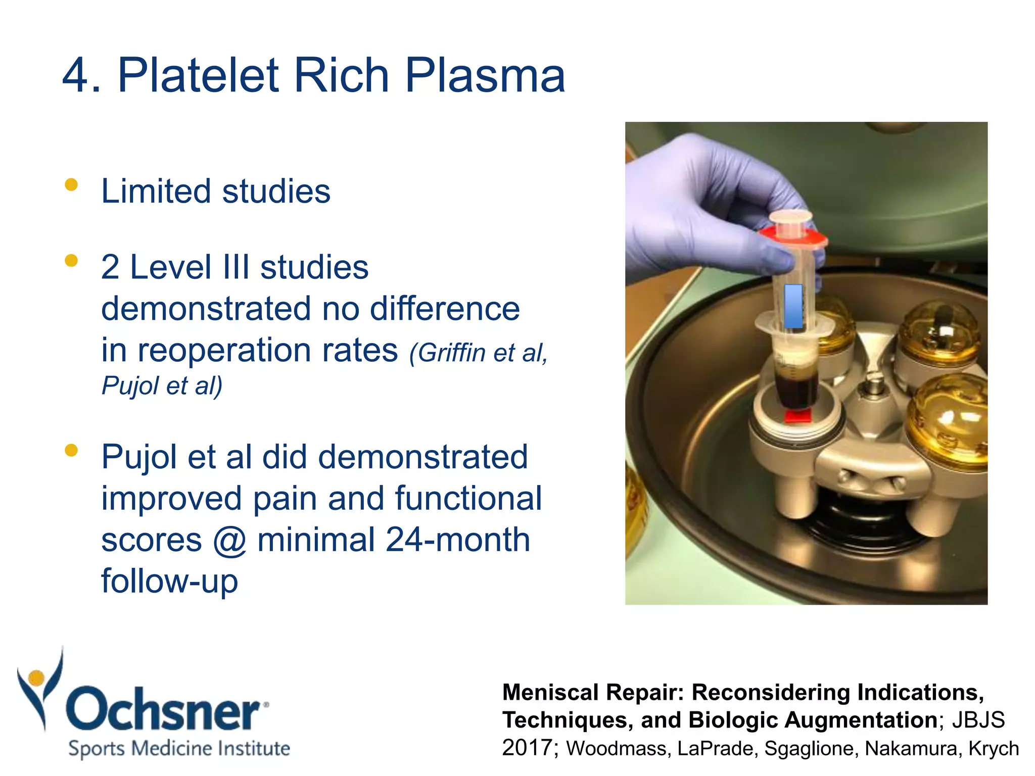 Meniscus Repair with Biologic Augmentation | Baton Rouge Sports ...