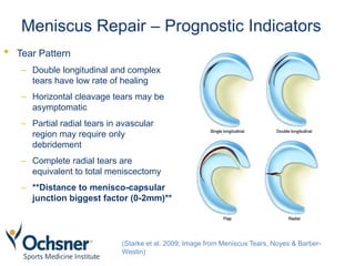 Meniscus Repair with Biologic Augmentation | Baton Rouge Sports ...