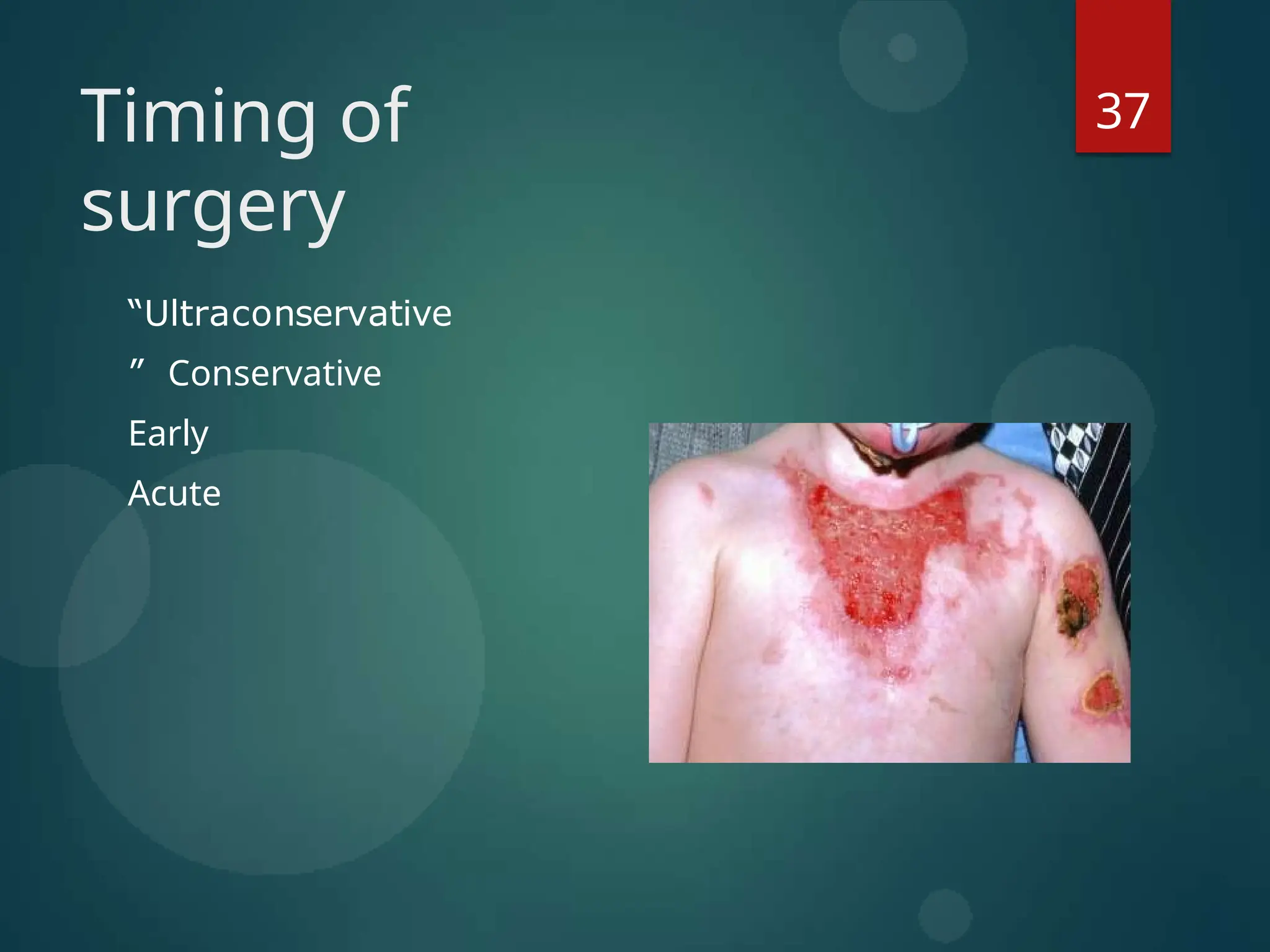 BURN HISTORY,PHYSICAL EXAMINATION OF BURN & PATHOPHYSIOLOGY.pptx