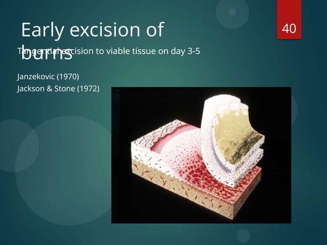 BURN HISTORY,PHYSICAL EXAMINATION OF BURN & PATHOPHYSIOLOGY.pptx