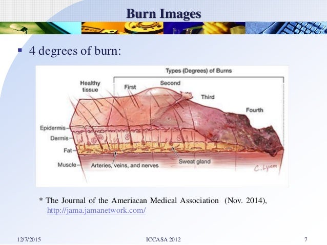 Burn image classification using support vector machine
