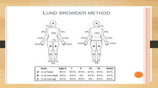 Burn in children | PPTX