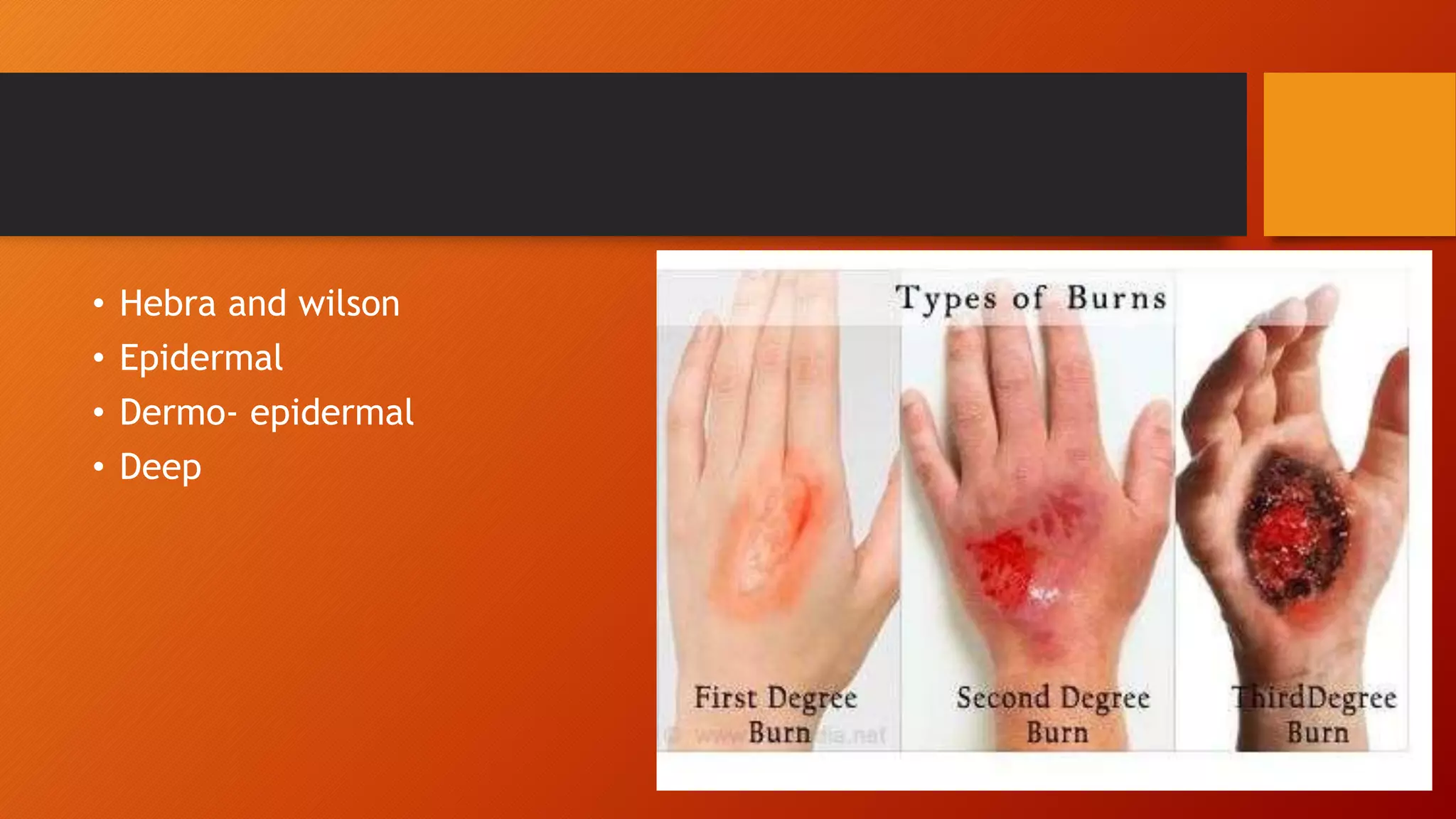 burn injuries - Copy.pptx