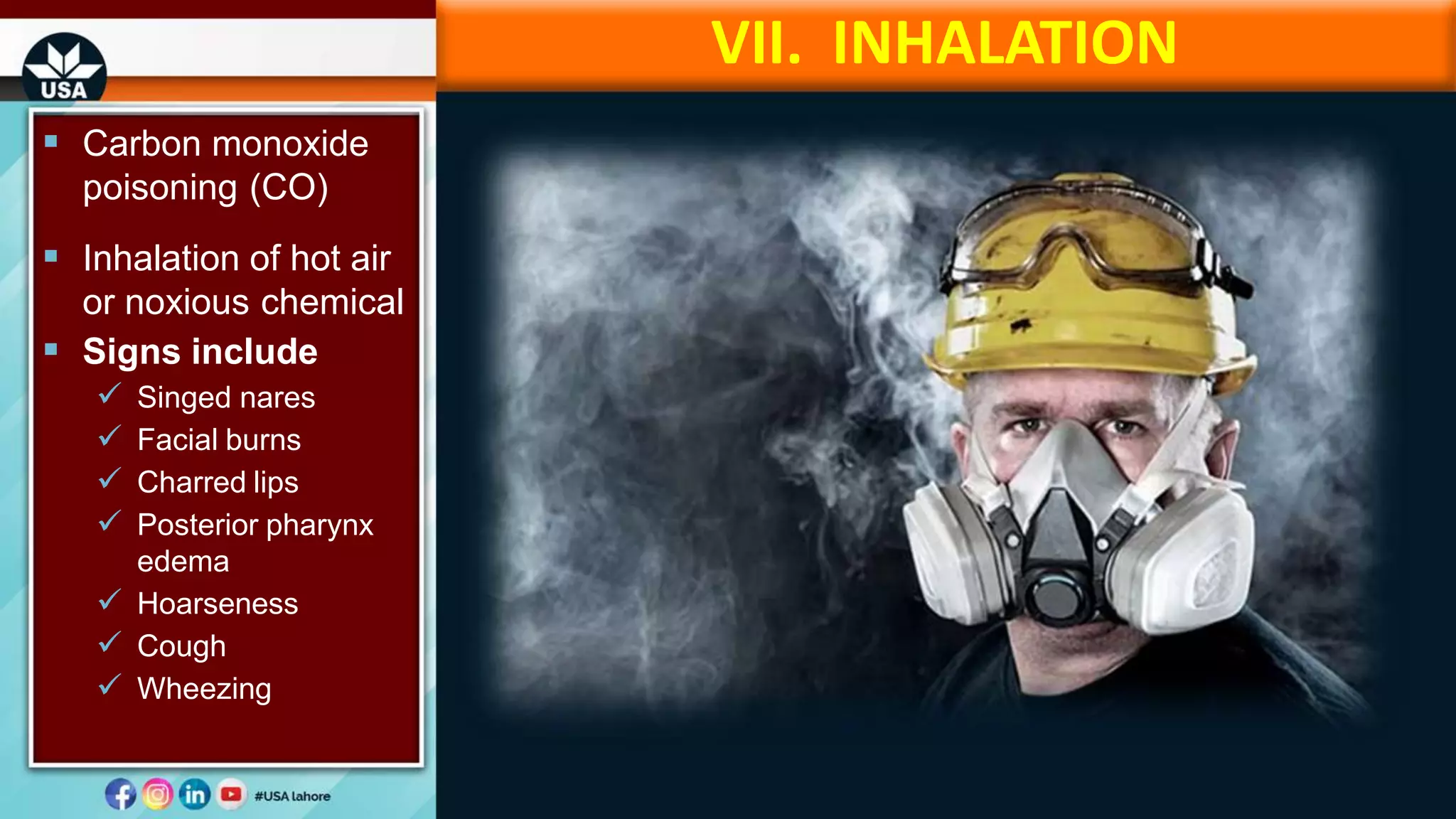 Burn injuries, classification and management | PPTX