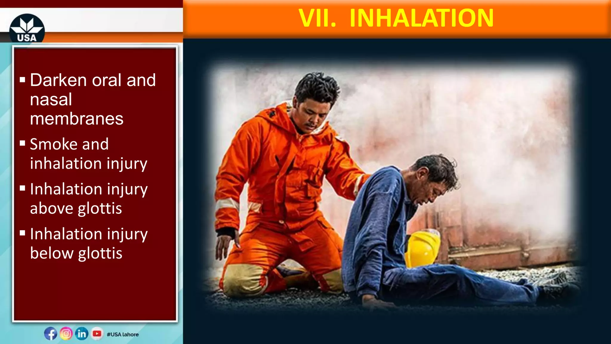 Burn injuries, classification and management | PPTX