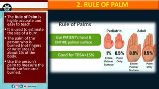Burn injuries, classification and management | PPTX