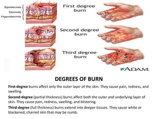 Burn injury | PPT