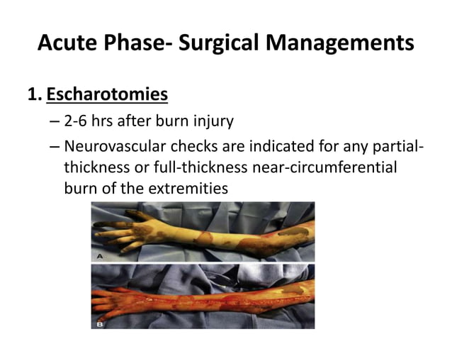 Burn Injury.pptx
