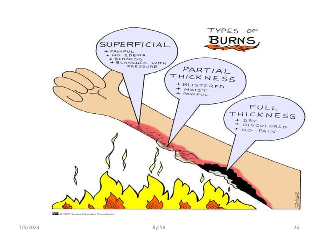 Burn injury for midwife.pptx | Death, Injury, or Military Conflict ...