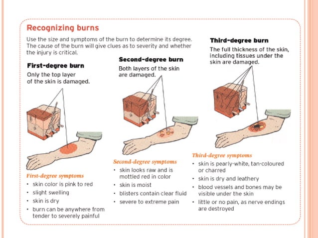 Burn lecture | PPT | First Aid | Injuries