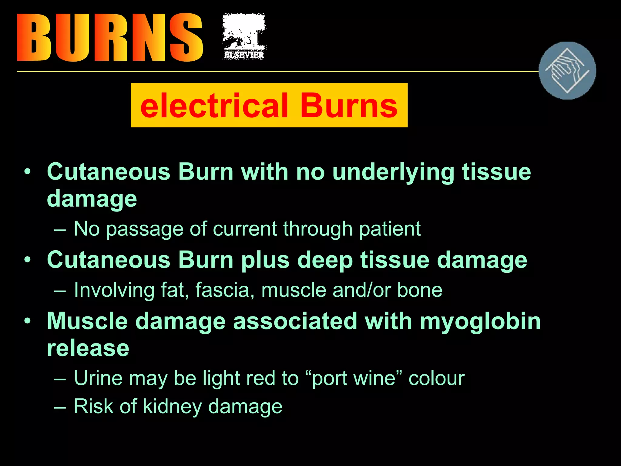 Burn management | PPT