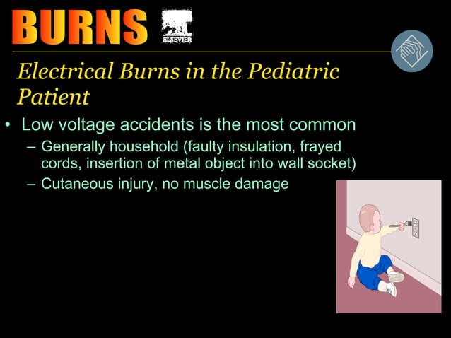 Burn management | PPT