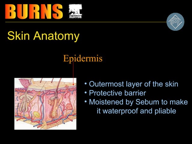 Burn management | PPT