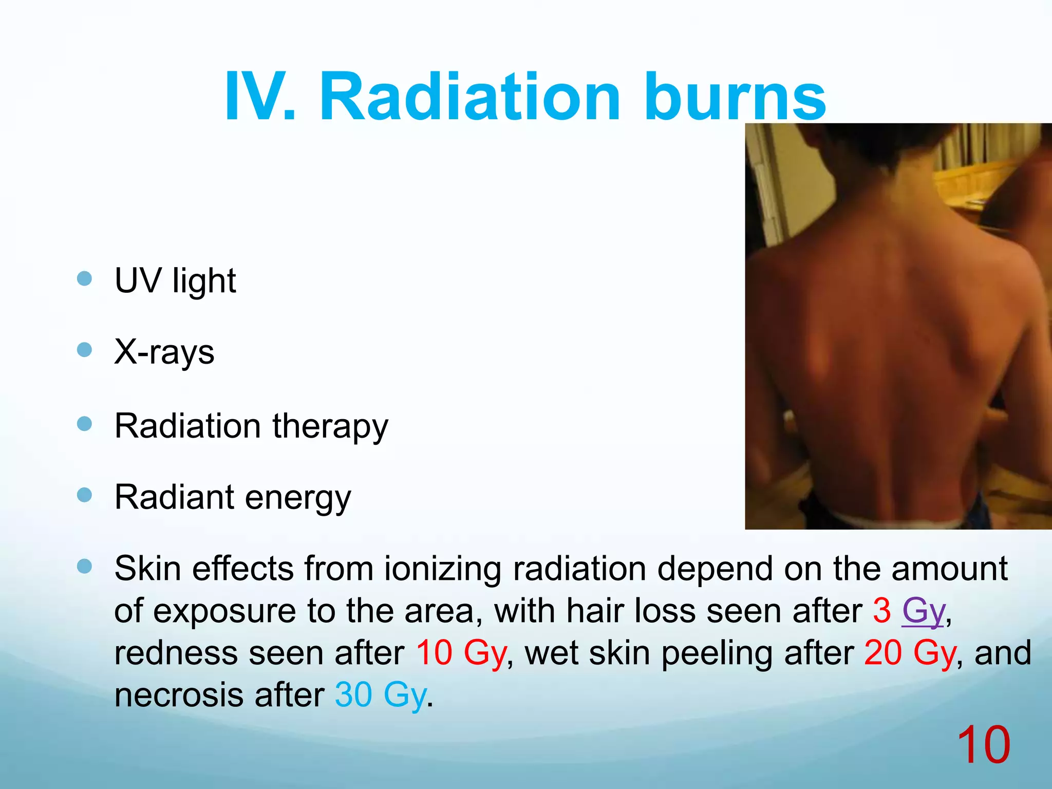 Burn management | PPTX