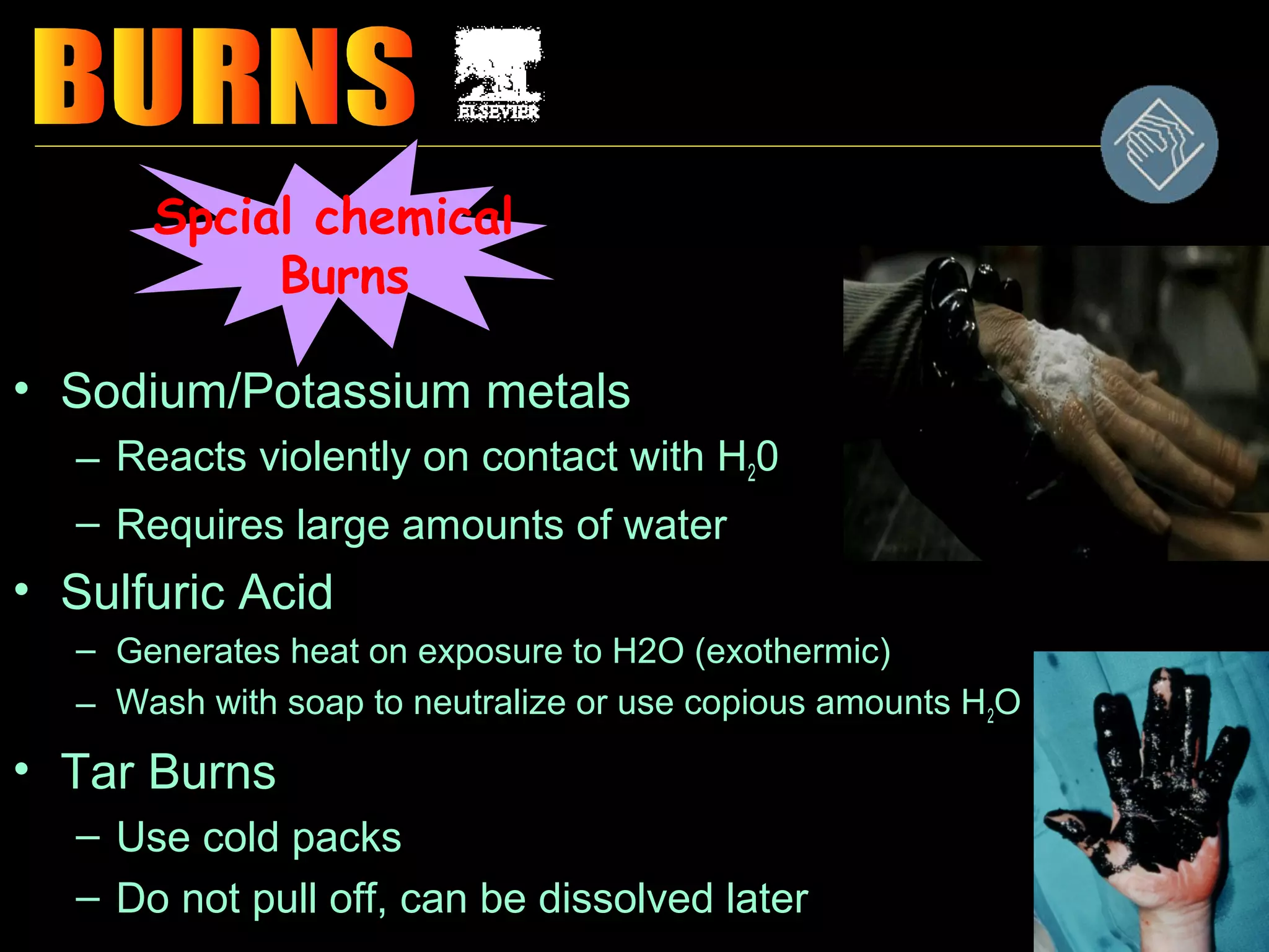 Burn management Dr.Mahmoud Ameen | PPT