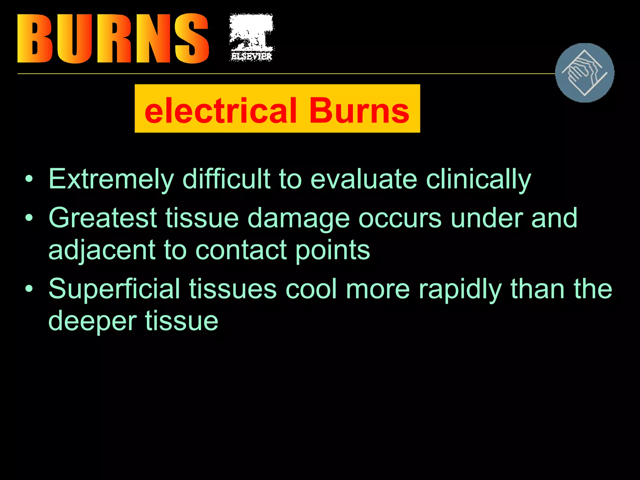 Burn management Dr.Mahmoud Ameen | PPT