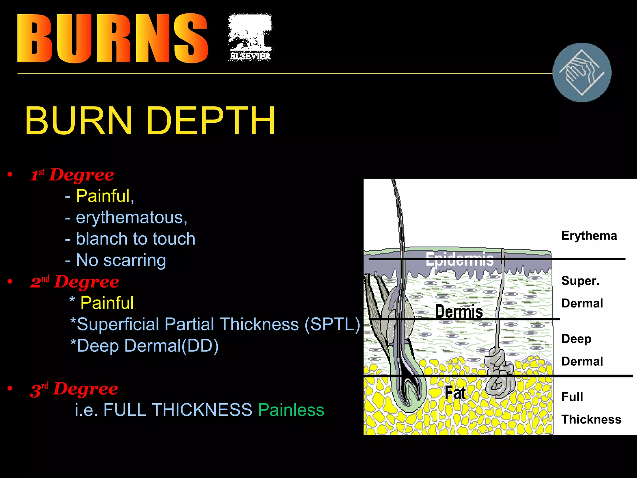 Burn management Dr.Mahmoud Ameen | PPT