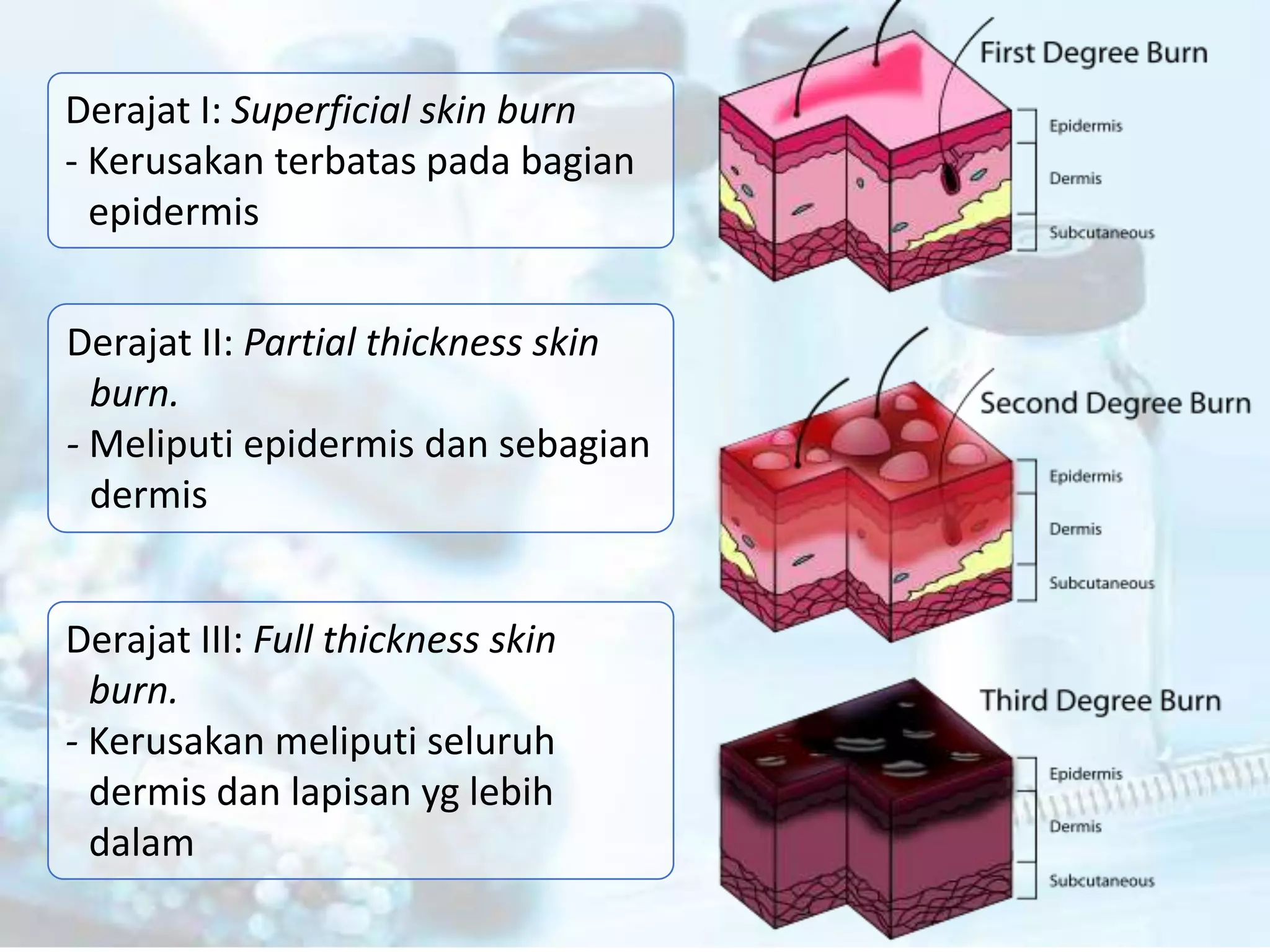 Burn management | PPTX