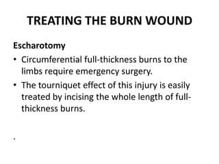 Burn ppt shashi | PPTX