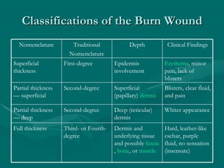 Burns | PPT