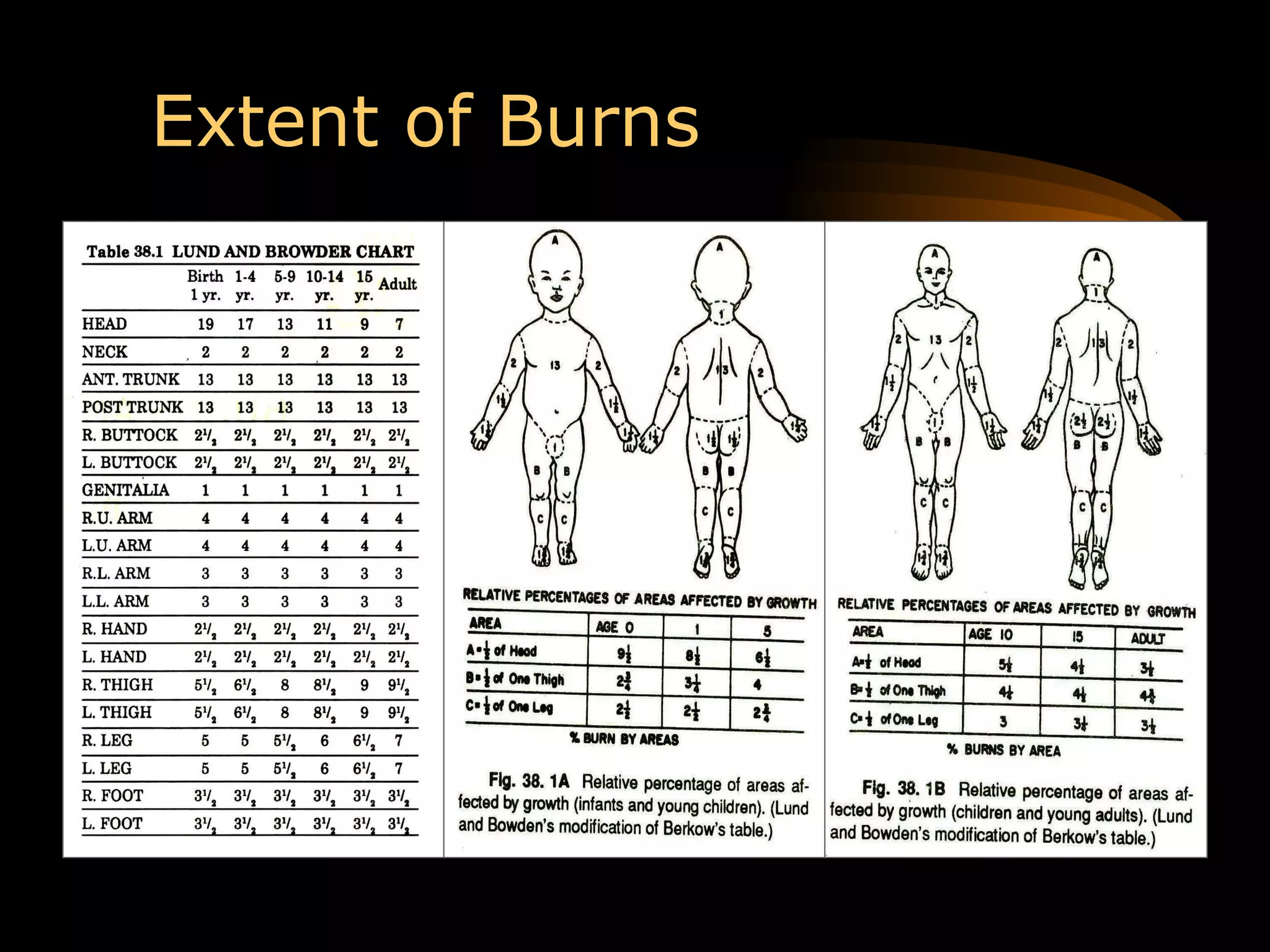 Burns | PPT | Death, Injury, or Military Conflict | Sensitive Topics