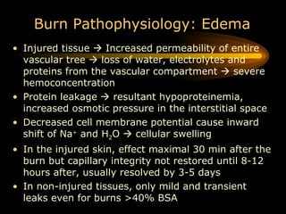 Burns | PPT