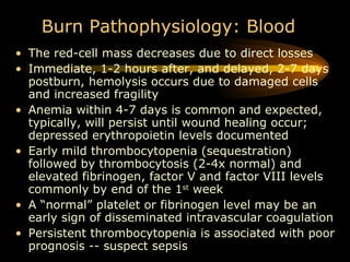 Burns | PPT