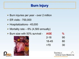 Burns | PPT