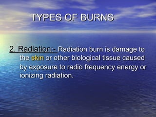Burns | PPT