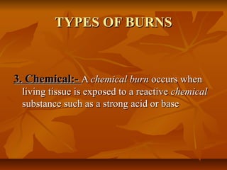 Burns | PPT