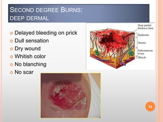 Burn Injury Typess Classification Causes Assesment and Managment | PPTX