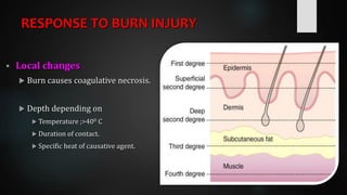 Burns | PPT