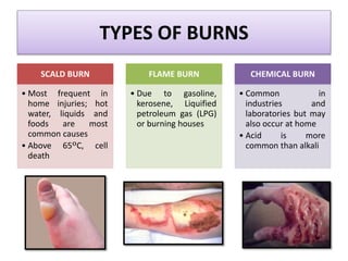 Burns | PPTX