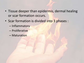 Burns | PPTX
