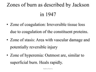 Burns | PDF