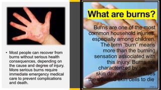 Burn burn to human body | PPT