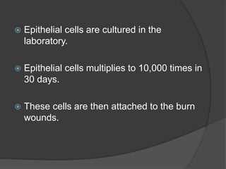Burns its types, causes and management. | PPTX