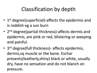 Burns.ppt