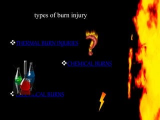 BURNS.pptx