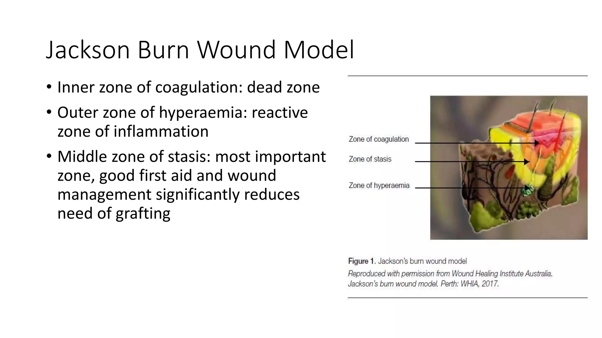 Burns.pptx