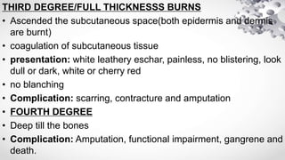 burns(edited).pptx