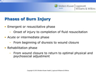 Burns.ppt