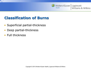 Burns.ppt